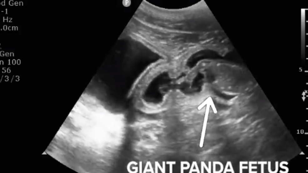 National Zoo giant panda's ultrasound shows exciting movement, baby cub ...