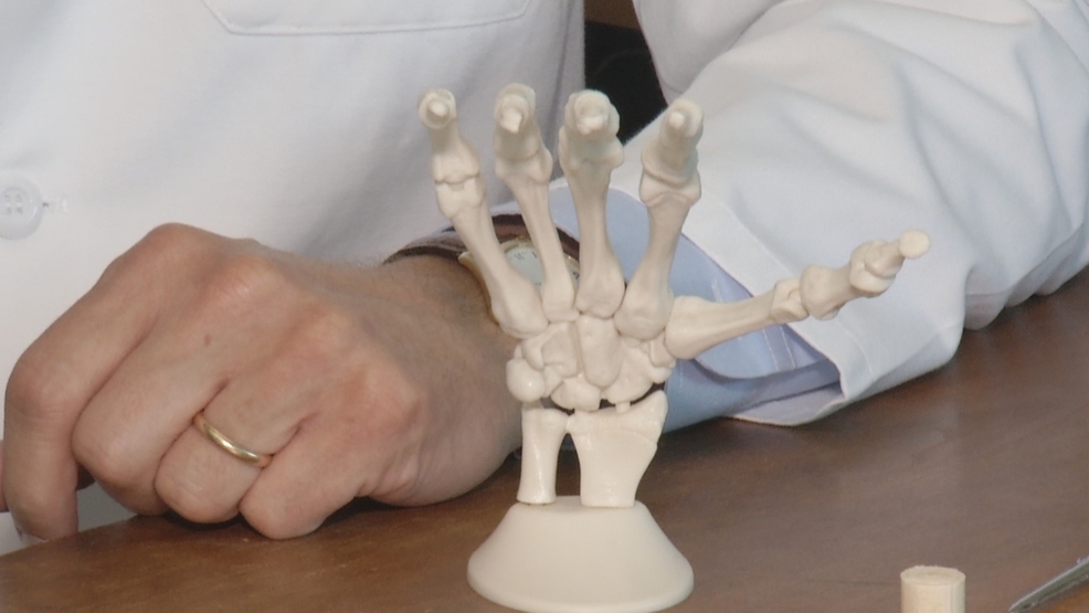 Health Check: New thumb implant device fixes arthritis | WJAR